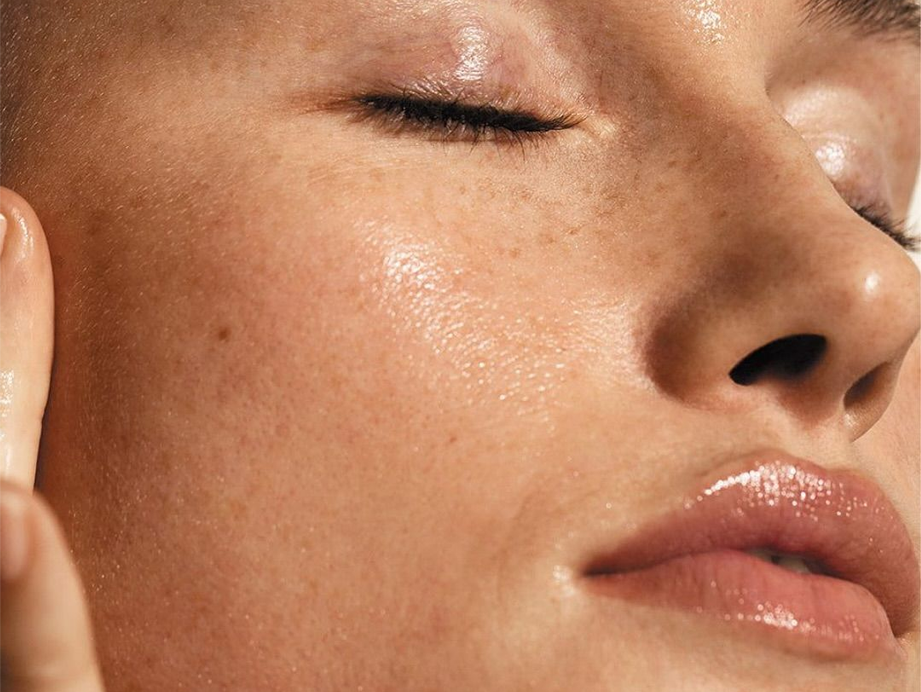 Pigmentation Treatment on the Central Coast | Sun Spots, Melasma & How ...